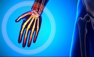 Wrist Activity Advice and Modifications (MSK Patient Portal) – NHS ...