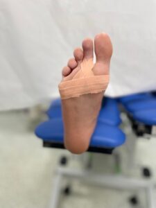 Plantar plate injury (MSK Patient Portal) - NHS Ayrshire & Arran