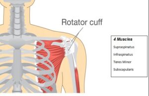 What’s Wrong with my Shoulder? – Weak and Painful Shoulder (MSK Patient ...
